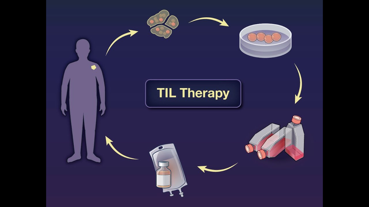 Tumor-Infiltrating Lymphocytes in Advanced Melanoma | NEJM