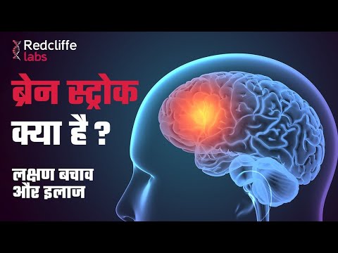 Brain Stroke Kya hota hai Aur kyu hota hai | Brain Stroke स्टोक के लक्षण बचाव और इलाज | #Redcliffe
