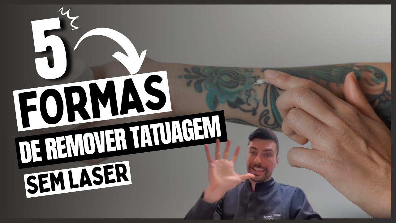 5 formas de remover tatuagem sem usar laser