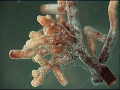 Ectomycorrhizal | Wikipedia audio article