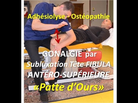 Comment soigner gonalgie ? La réponse est sur Admicile.fr