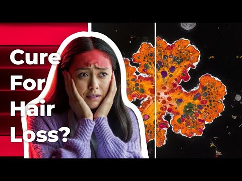 4 Essential Facts About Lichen Planopilaris You Need to Know