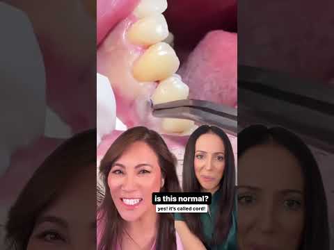 cord packing dental crowns #shorts remix with @DrPimplePopper