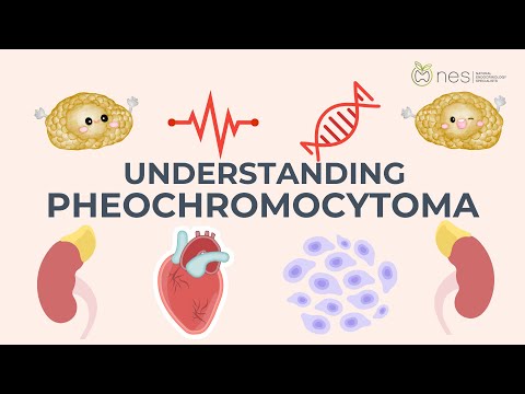 Understanding Pheochromocytoma