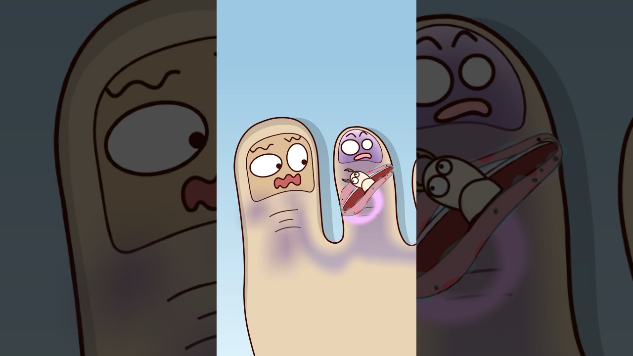 This Doctor Uses Maggots to Heal Wounds – And It Actually Works!#animation #funny #shorts