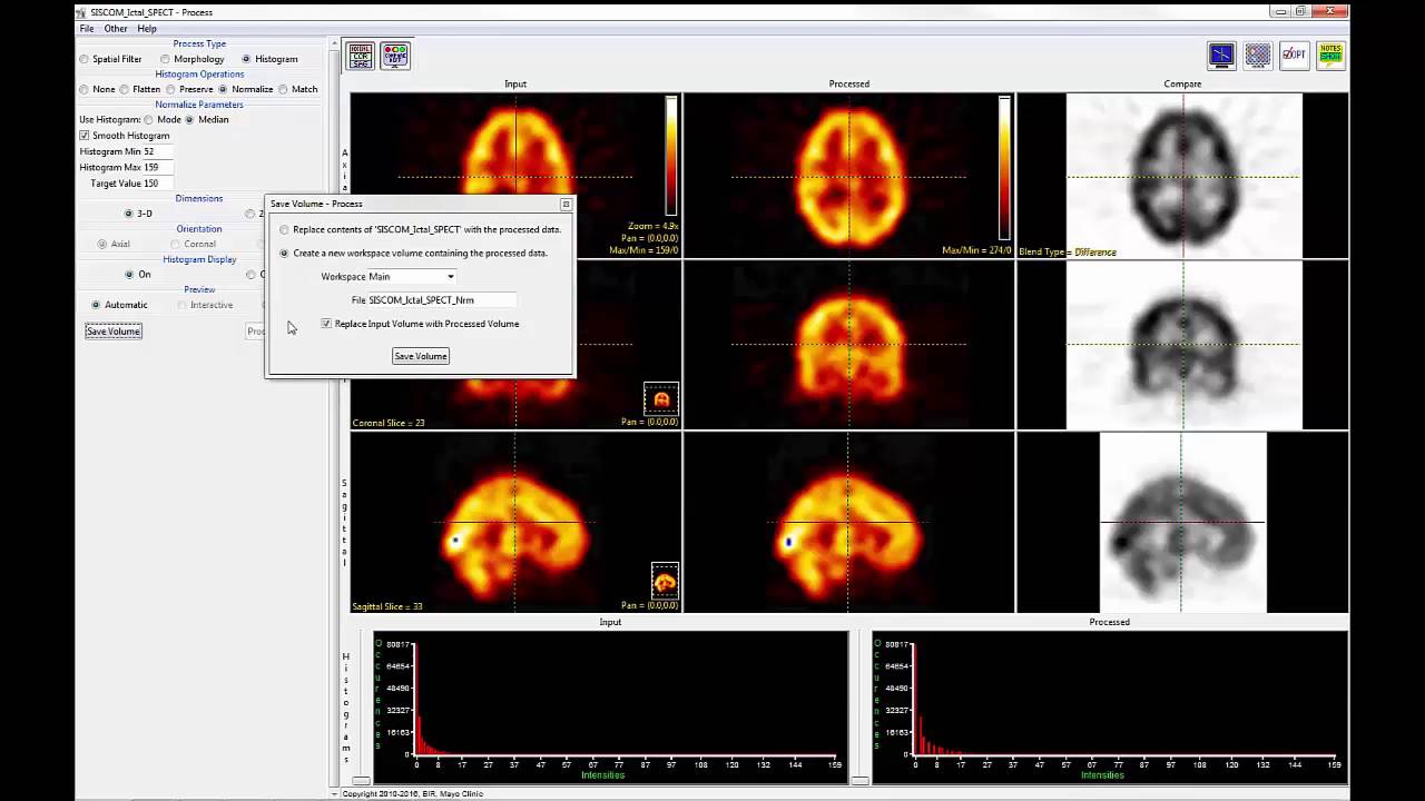 AnalyzePro: Histogram Normalization