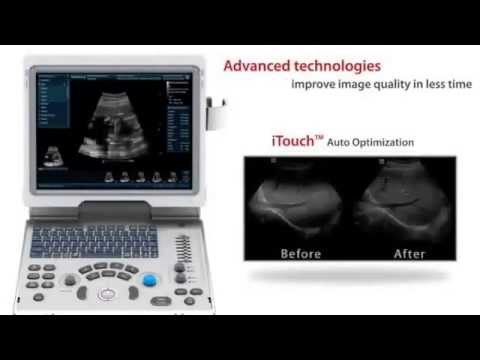 Philips Ultrasound Machine - Latest Price, Dealers & Retailers in India