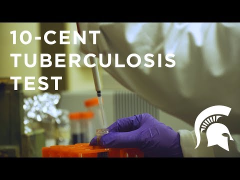 10-Cent Tuberculosis Test