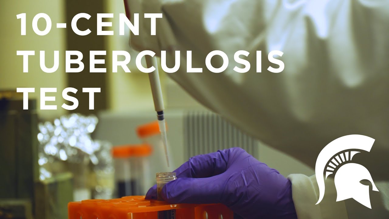 10-Cent Tuberculosis Test