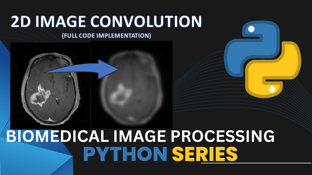 2d Image Convolution in Python | Code implementation | Biomedical Engineering