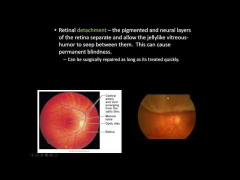 Eye