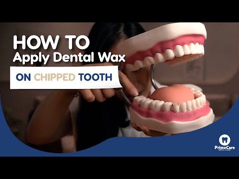 How to apply dental wax on chipped tooth