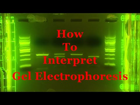 Interpreting Gel Epectrophoresis