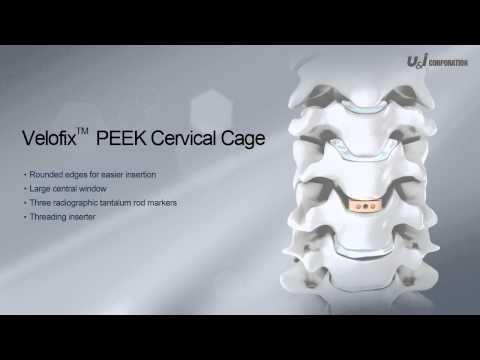 Velofix™ PEEK Cervical (by U&I CORPORATION)