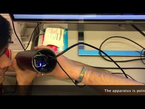 Dermopleno - Using Light Field Technology for Melanoma Detection