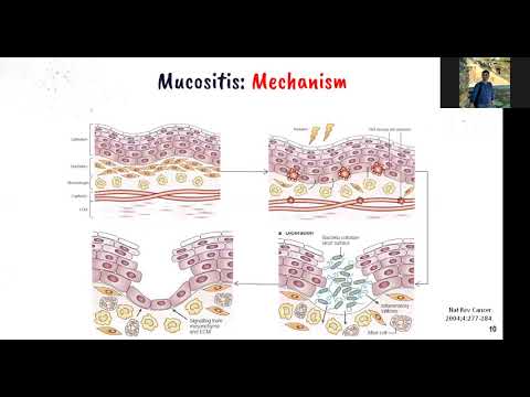 Virtual Training session on 22.10.2020: MUCOSITIS- PREVENTION AND TREATMENT