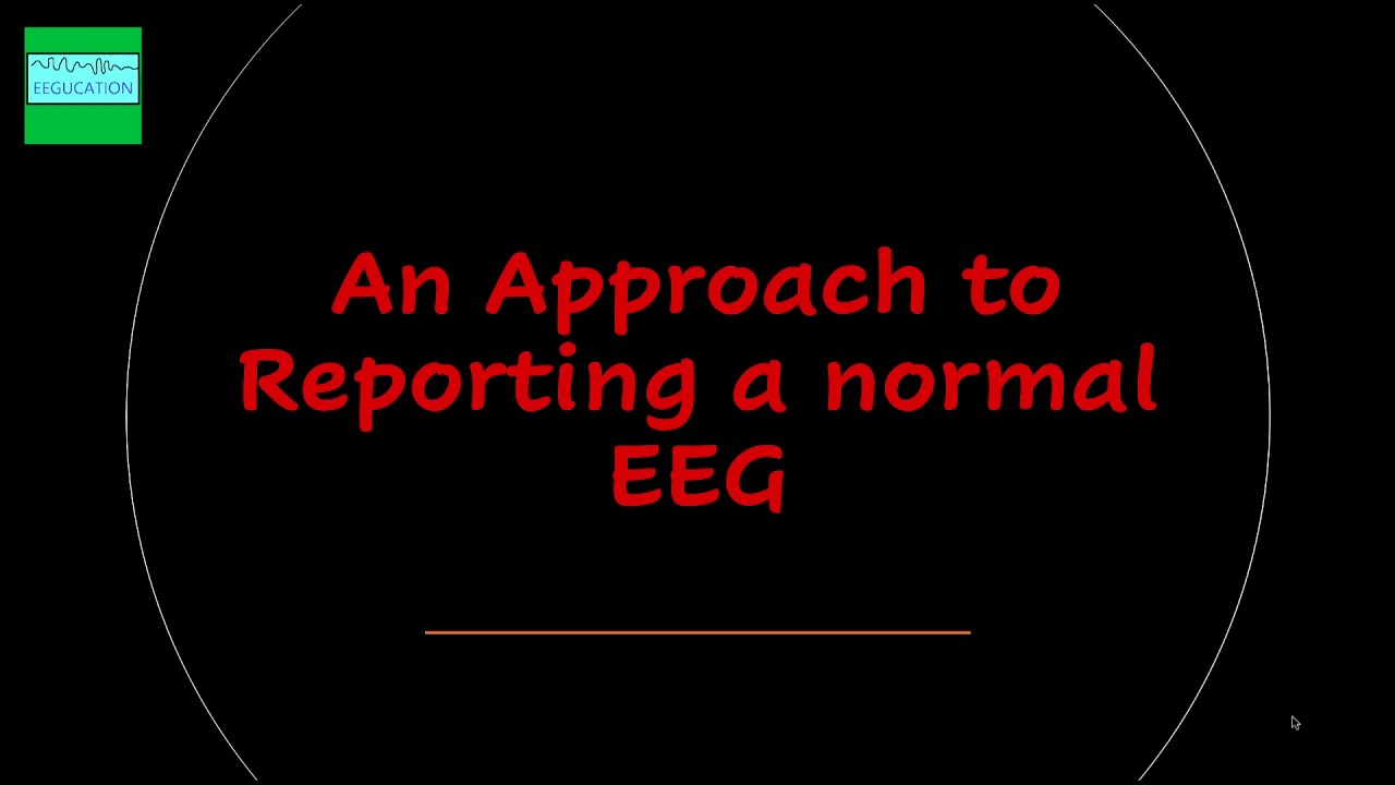 An Approach to Reporting a Normal EEG