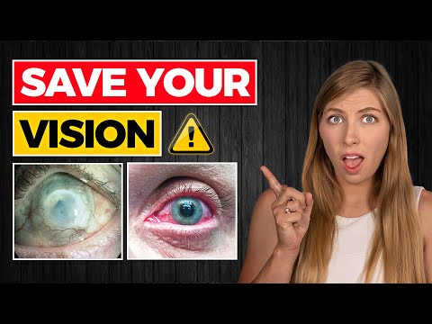 Blindness In 2 Hours Or LESS | How To Prevent Conditions That Cause Permanent Vision Loss