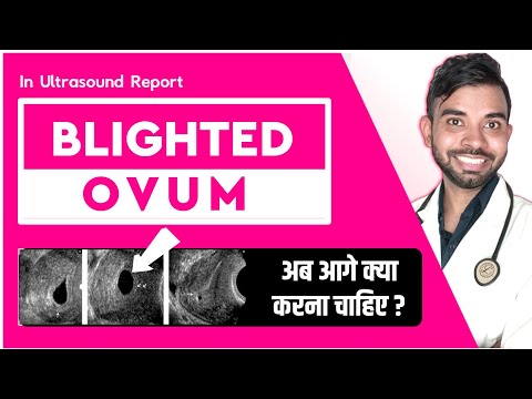 Blighted ovum pregnancy in hindi | blighted ovum in ultrasound | blighted ovum causes & treatment