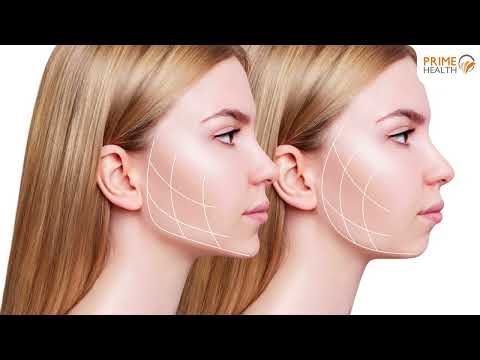 Fillers by Dr Ameena Jaleel at PRIME Medical Center Jumeirah