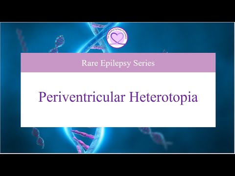 What is Periventricular Heterotopia?