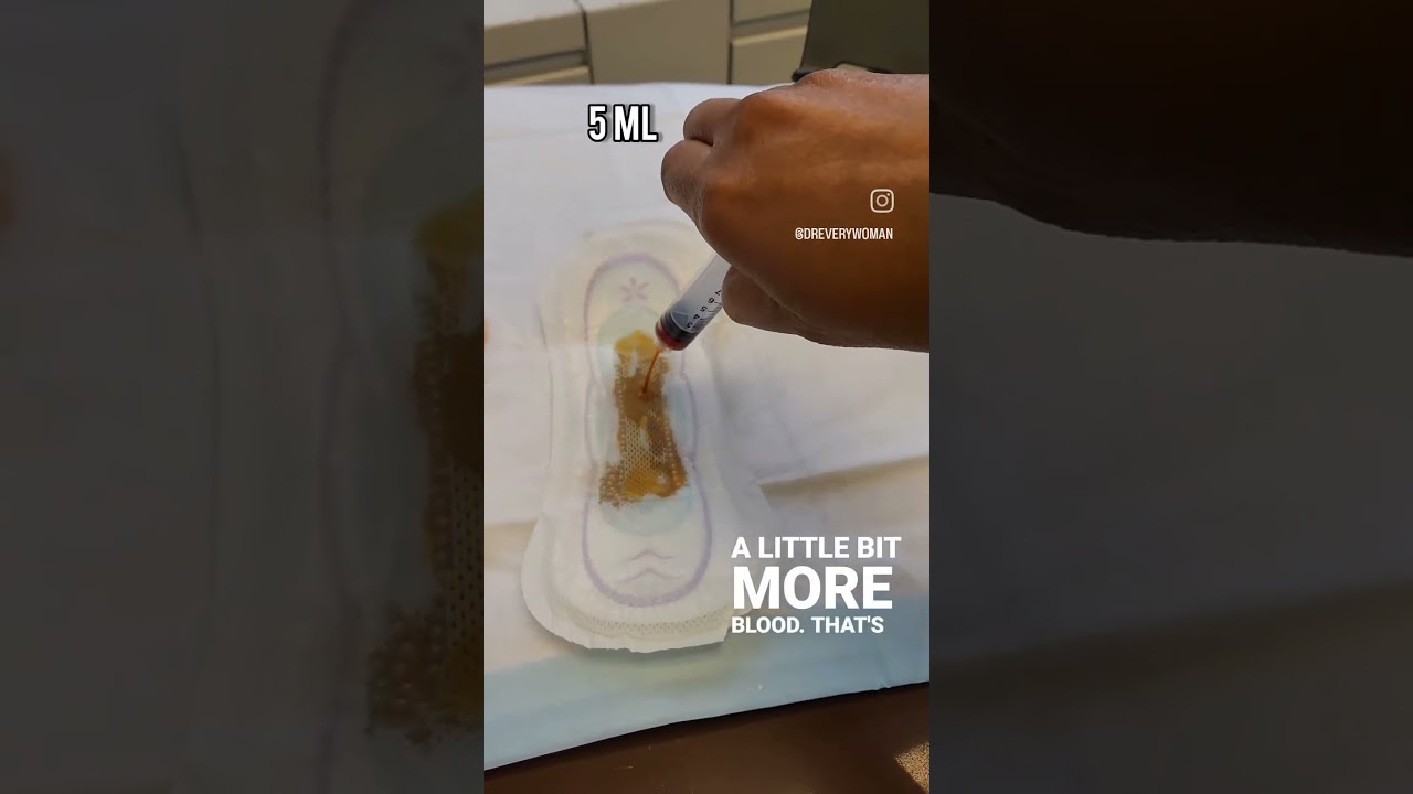 How much is too much period blood loss? #obgyn #menstruation #dreverywoman #period