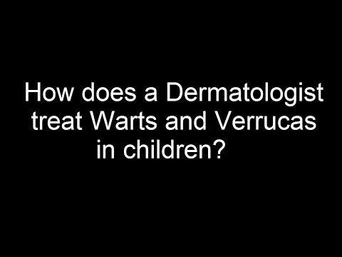 How does a Dermatologist treat Warts and Verrucas in children