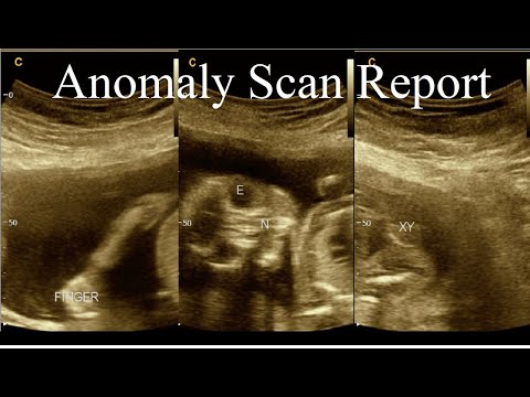 No gross anomaly is detected | Anomaly scan report | Amader hospital | আমাদের হাসপাতাল