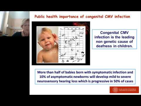 Management of TORCH infections during pregnancy