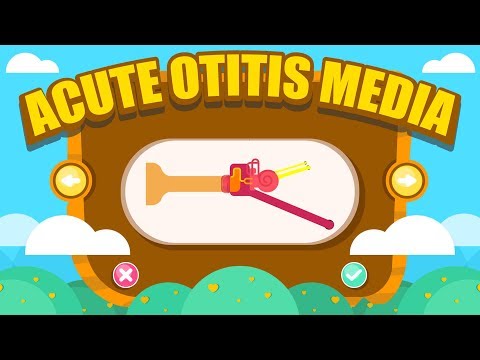 What is Acute Otitis Media?