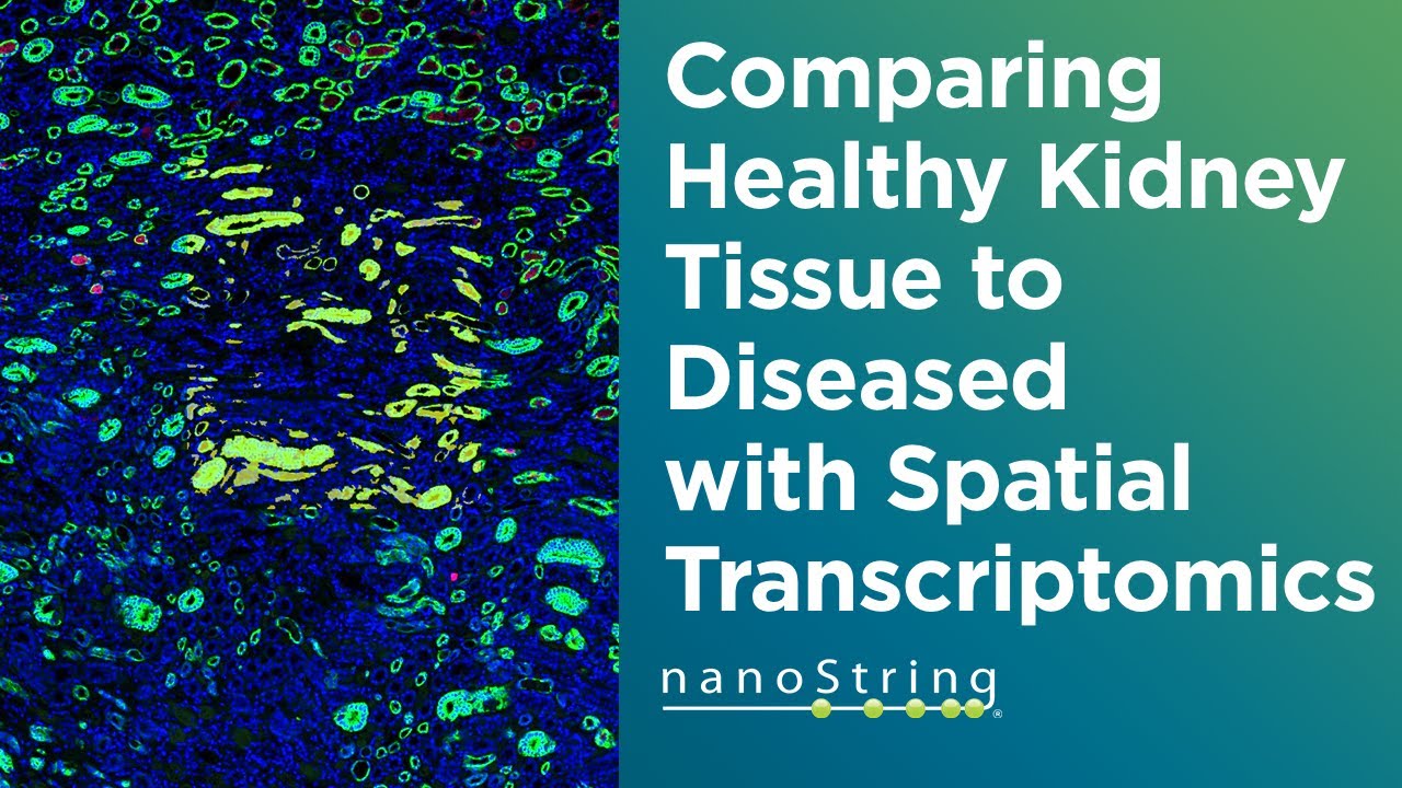 Spatial Transcriptomics | NanoString