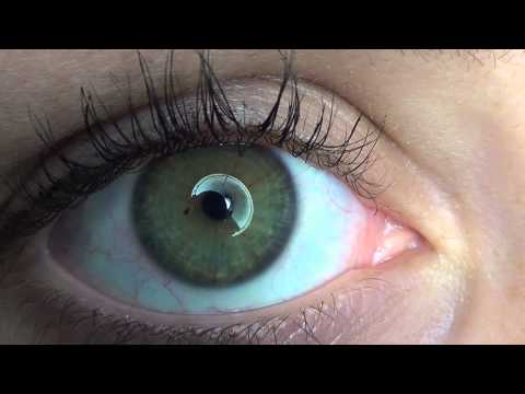 How I made my eye dilate