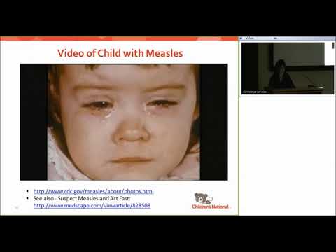 Measles Update 2017