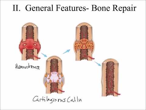 Bone Remodeling and Repair