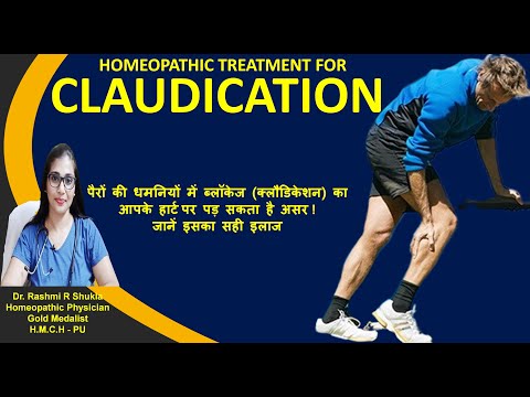 पैरों में सुन्नपन /ठंडे पड़ें /तेज़ दर्द होता हो तो ये है बड़ी बीमारी का संकेत| Claudication homeopathy