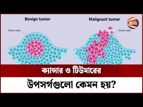 ক্যান্সার ও টিউমারের উপসর্গগুলো কেমন হয়? | Cancer vs Tumor | Channel 24