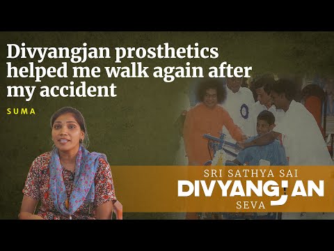 Divyangjan prosthetics helped me walk again after my accident | Sri ...