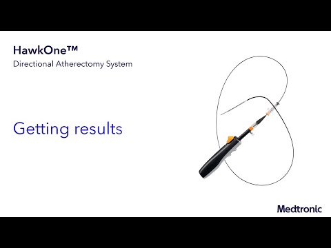 HawkOne™ Directional Atherectomy System - How To Get Results
