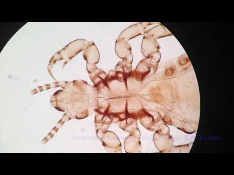 Pediculus humanus