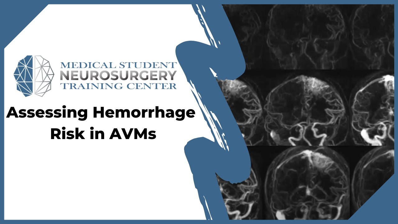 Assessing Hemorrhage Risk in AVMs