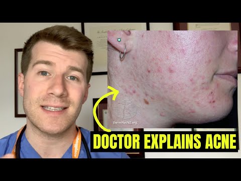Doctor explains ACNE symptoms, self-care, treatment options and complications...
