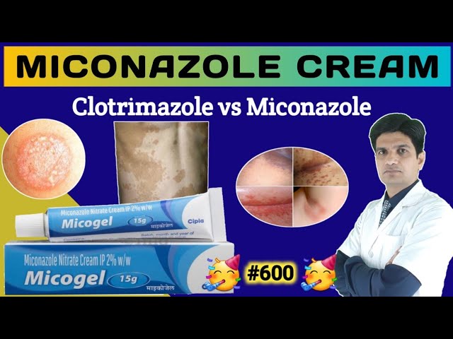 Antifungal Medicines - Ketoconazole Cream 2 W W Wholesale Supplier from ...