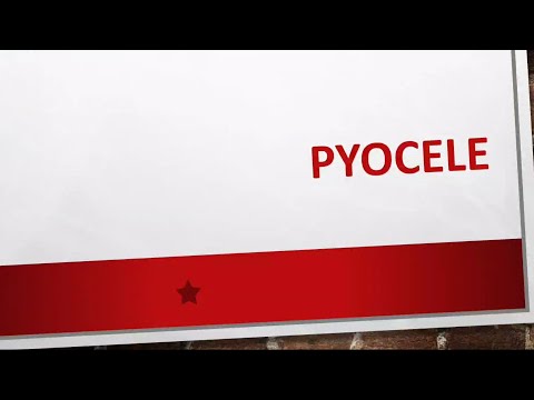Pyocele: Causes, Symptoms, and Treatment Explained. #PyoceleExplained