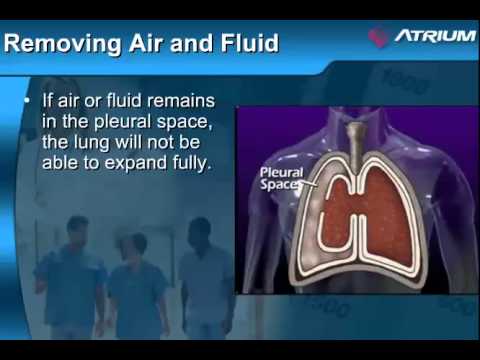 Chest Drainage 101