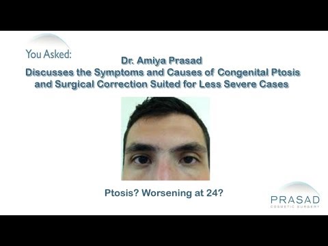 How to Address Congenital Ptosis (Drooping or Lazy Eyelid) as an Adult