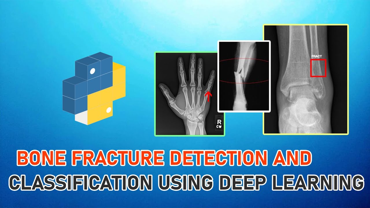 Bone Fracture Detection and Classification Using Deep Learning #python #pythonprojects #projectideas