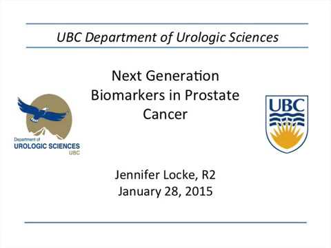 Next Generation Biomarkers in Prostate Cancer
