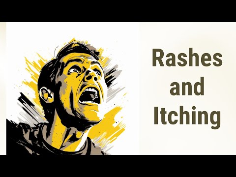 Don't Scratch the Itch: Understanding Rashes and Itching in English