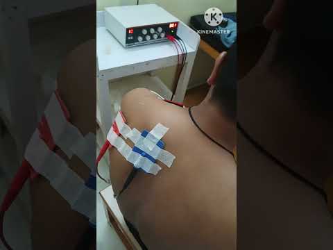 IFT use for Frozen shoulder#physiotherapist #rehabilitation