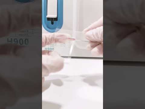 Low Platelet Count thrombocytopenia #laboratory #mls #cls #medtechstudent #medtech #platelets #blood